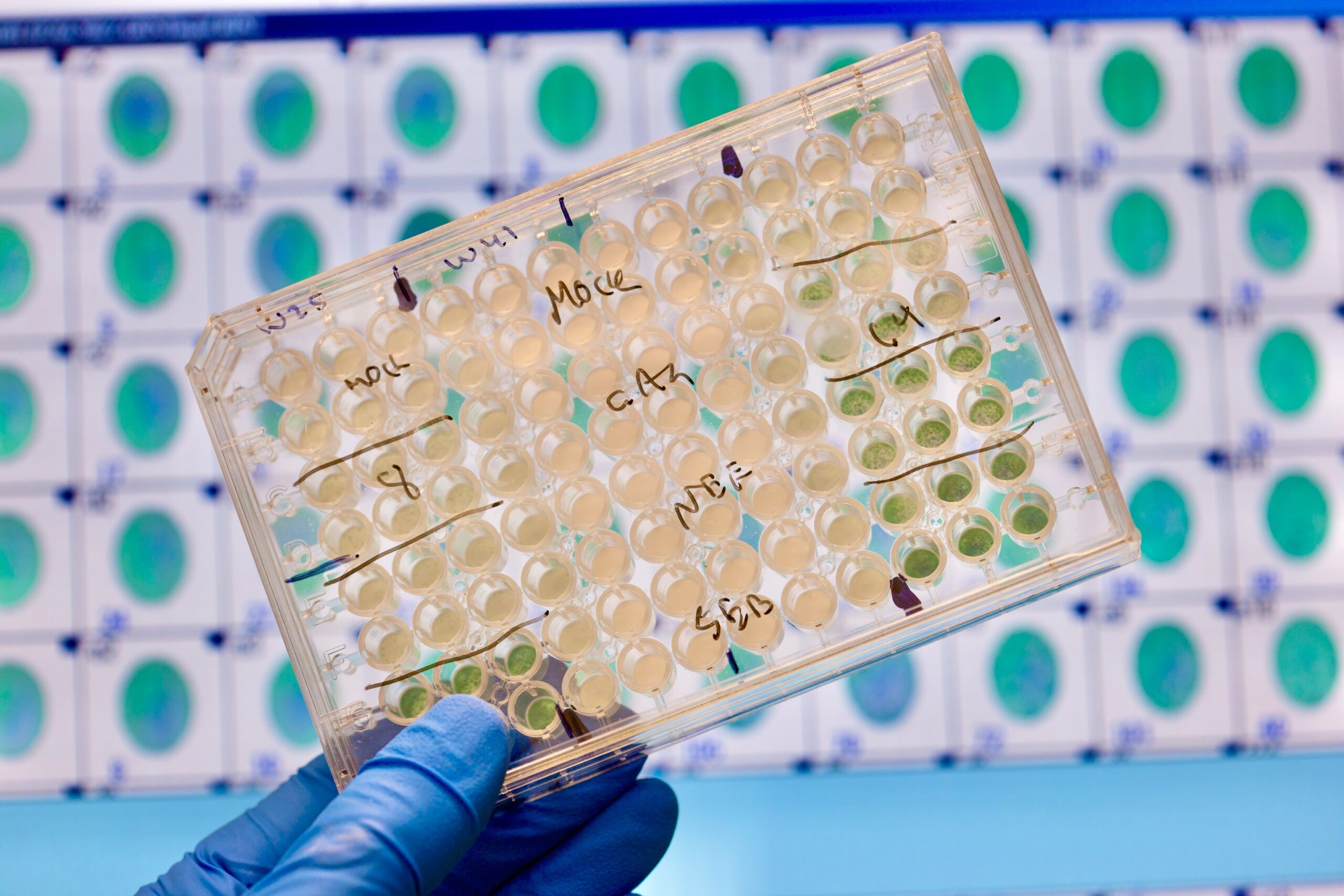 Senior Leadership - IAVI