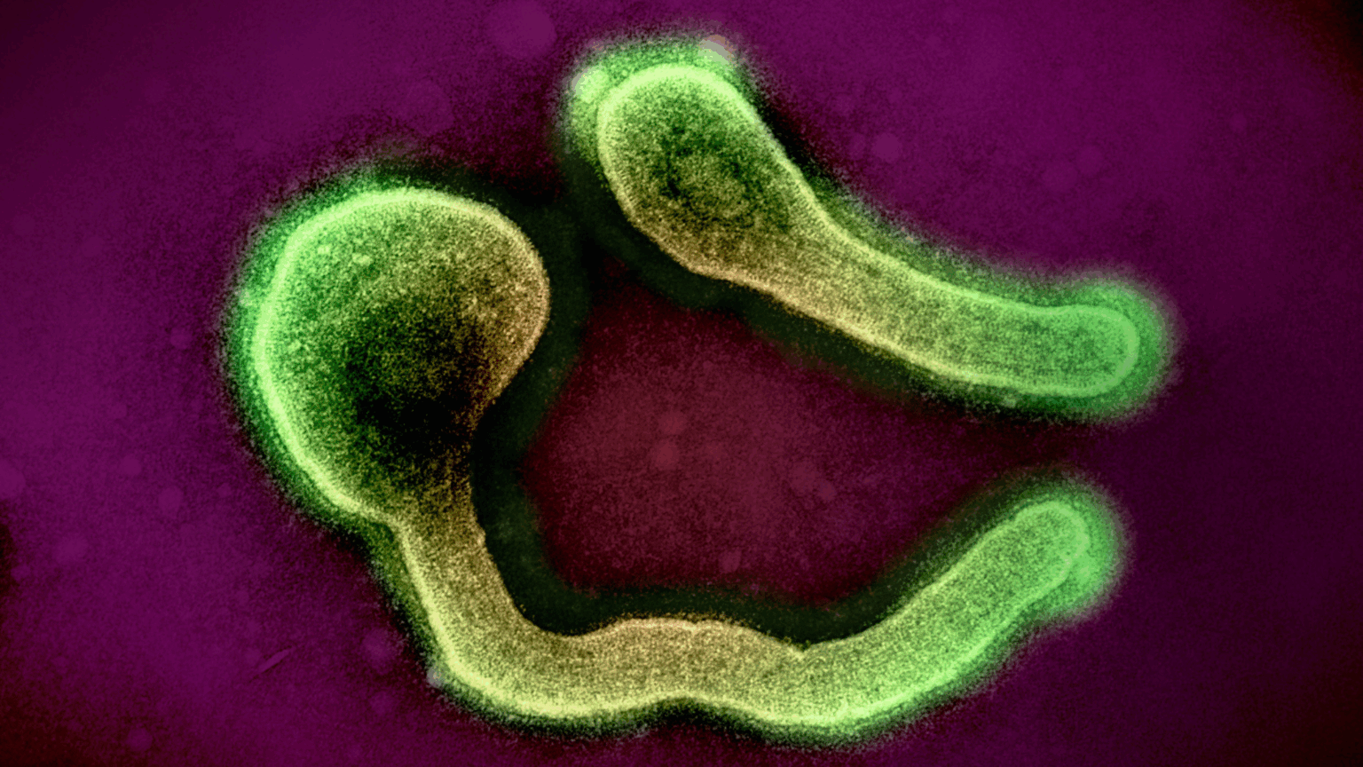 Frequently asked questions: Marburg virus disease - IAVI